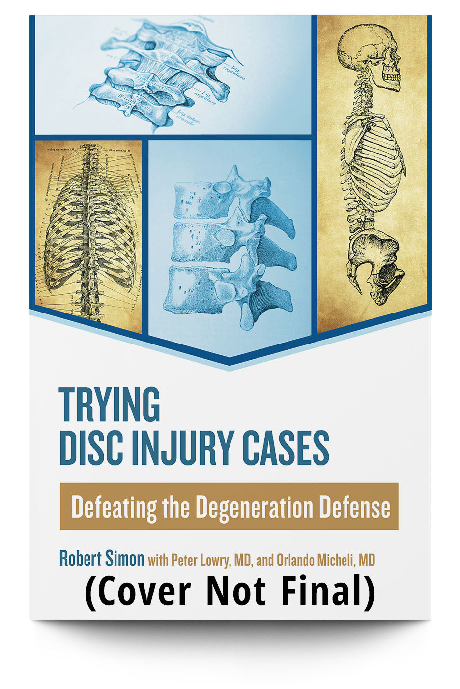 Trying Disc Injury Cases: Defeating the Degeneration Defense
